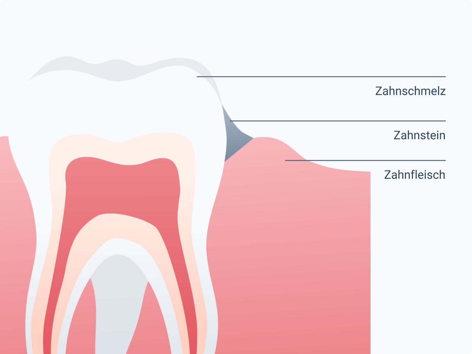 Zahnstein entfernen: Welche Methode wirklich hilft | Doctolib