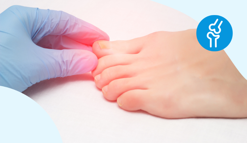 Alluce rigido: sintomi, cause e cure | Doctolib