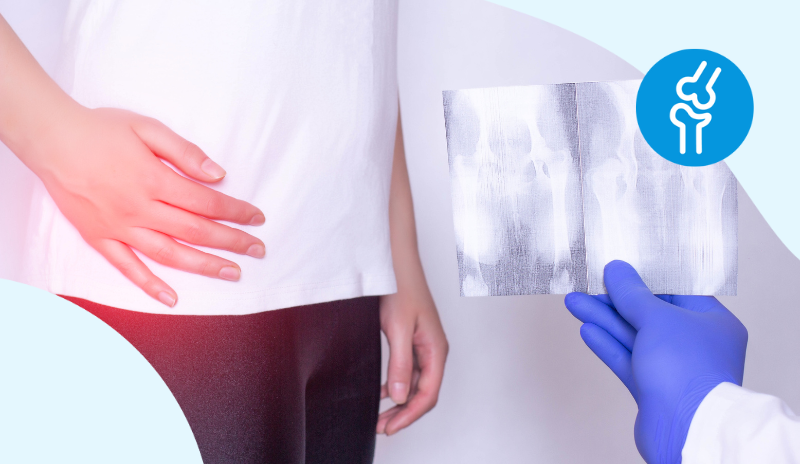 Coxartrosi: sintomi, cause, cure | Doctolib