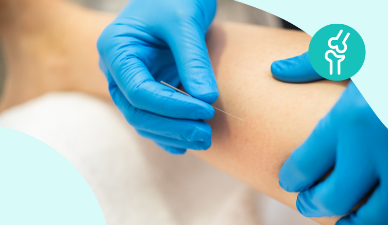 Sindrome compartimentale: sintomi, cure | Doctolib