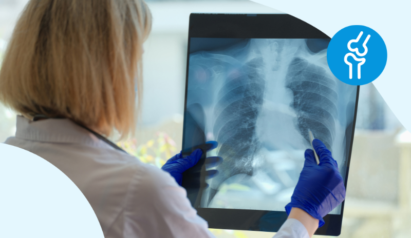 Pectus excavatum: sintomi, cause e cure | Doctolib