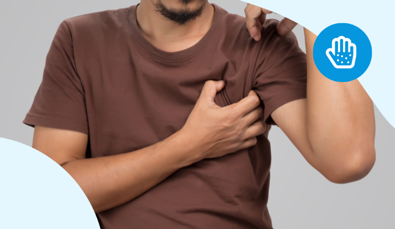 Eritrasma (cutaneo): sintomi, cause, cure | Doctolib