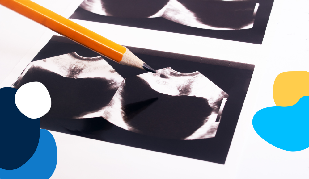 Ecografia prostatica: cos'è e a cosa serve | Doctolib