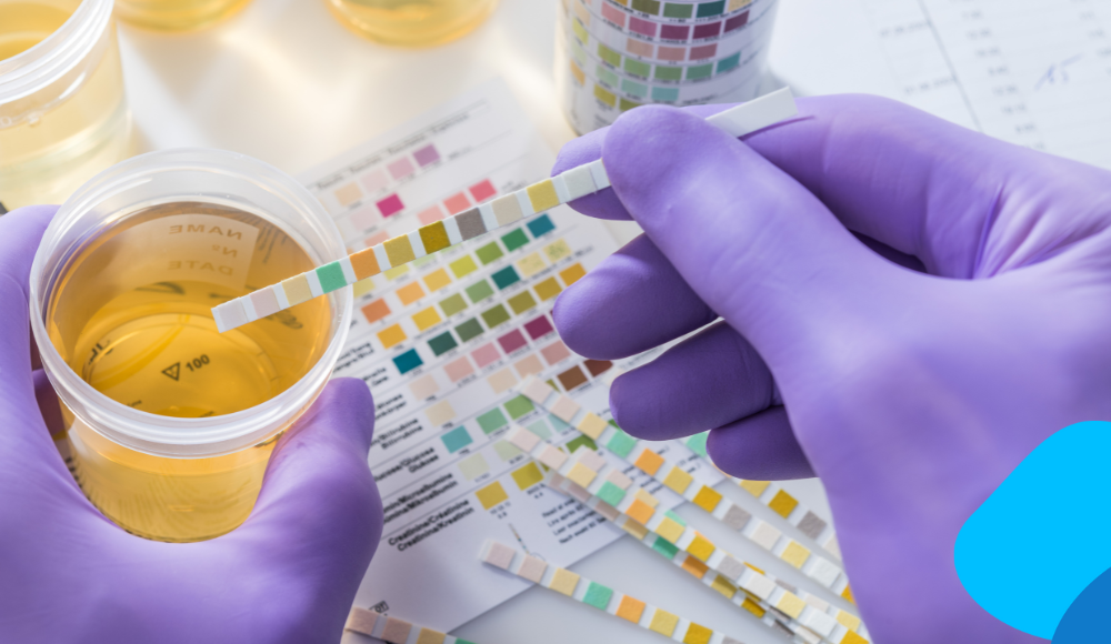 Urinocoltura: a cosa serve, come funziona | Doctolib