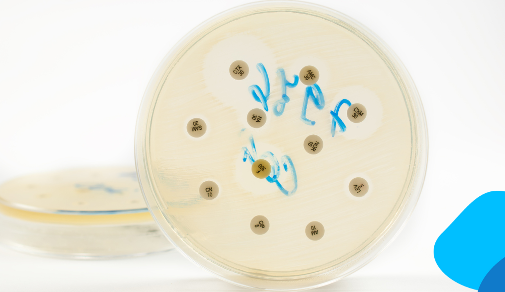 Urinocoltura: a cosa serve, come funziona | Doctolib