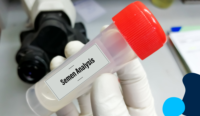 Astenospermia: sintomi, cure | Doctolib