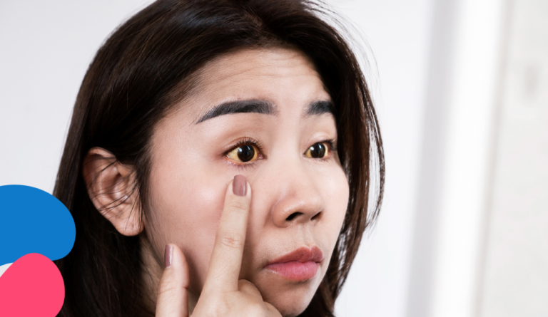 Ittero: cause, fattori di rischio, cure | Doctolib