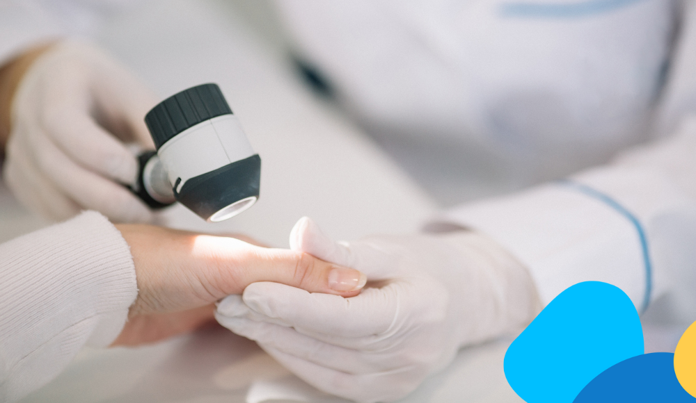 Dermatofitosi: sintomi, cause, cure - Doctolib