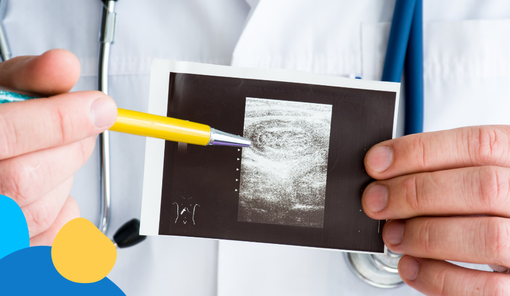 Ecografia delle anse intestinali: preparazione, cosa si vede