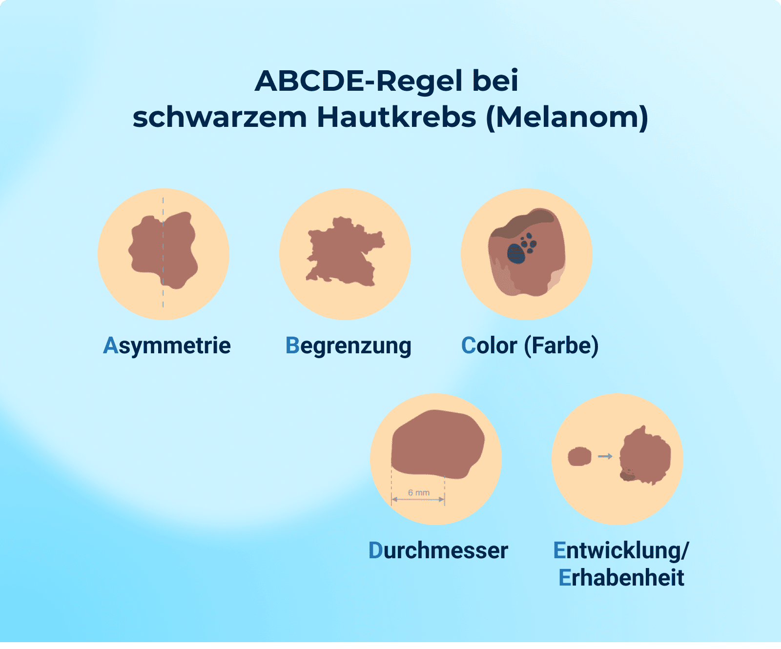 ABCDE-Regel: So wird Hautkrebs frühzeitig erkannt | Doctolib