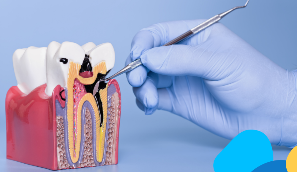 Pulpite: sintomi, cause, trattamenti, prevenzione