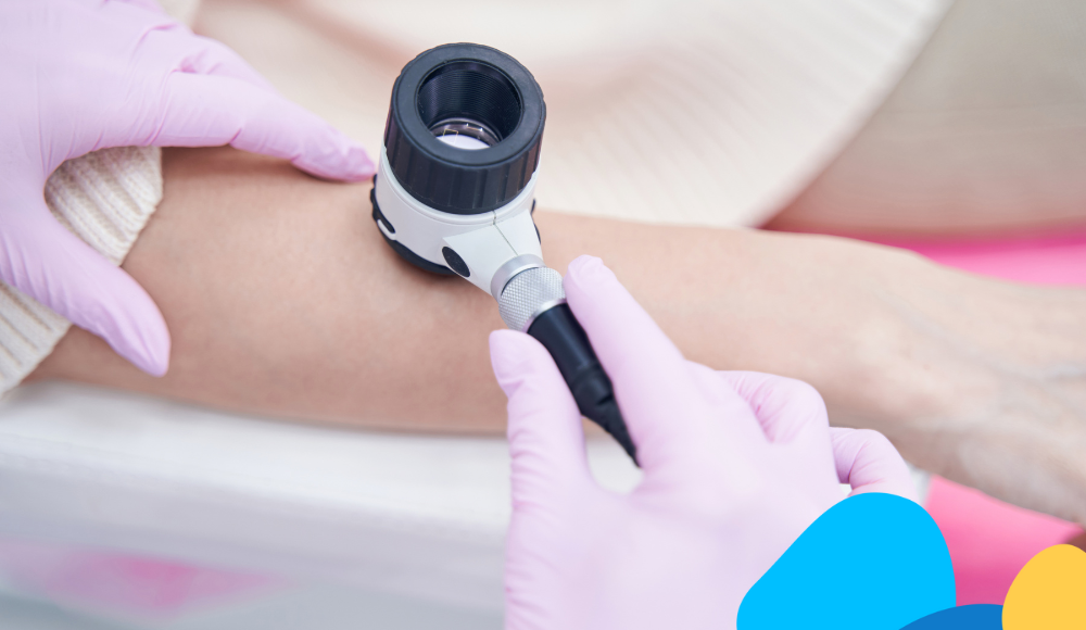 Granuloma anulare: sintomi, cause, cure | Doctolib