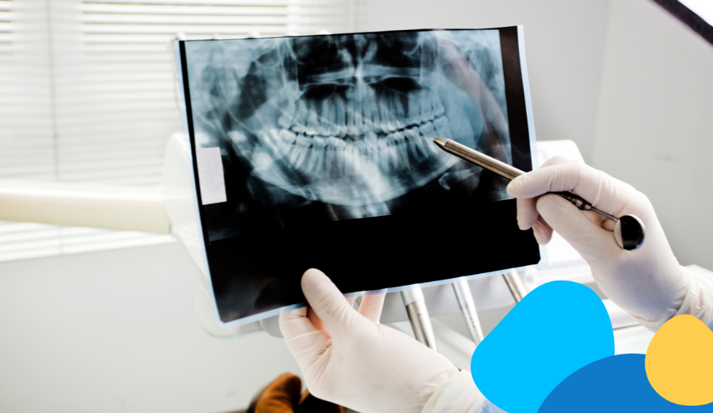 Gengive gonfie: sintomi, cause, trattamenti